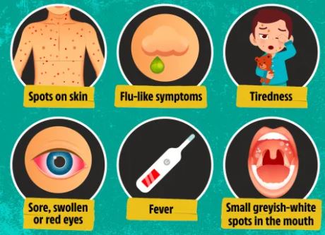Simptomat më pak të njohura të fruthit vdekjeprurës që mund t’i dalloni ...