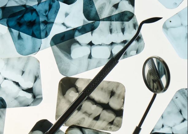 A janë të sigurta rrezet X dentare? - Klan Kosova